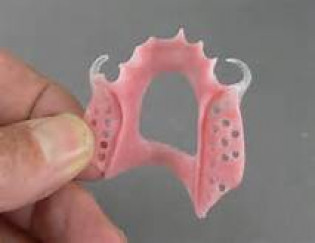 Metal-Free Partial Dentures | Amarillo, TX | Studio32 Dental Arts, LLC