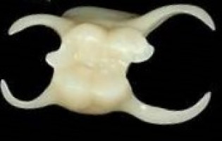 Metal-Free Partial Dentures | Amarillo, TX | Studio32 Dental Arts, LLC