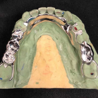 Dentures, Dental Supply Company | Amarillo, TX | Studio32 Dental Arts, LLC